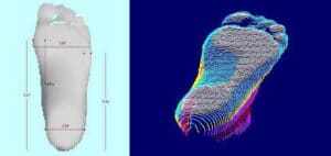 3D Orthotic Scanning - ModPod Podiatry