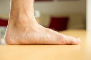 Flat Feet: Understanding and Treating Them Effectively