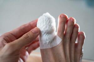 Infected Toe (A Guide To Your Dealing With Your Toe Pain)